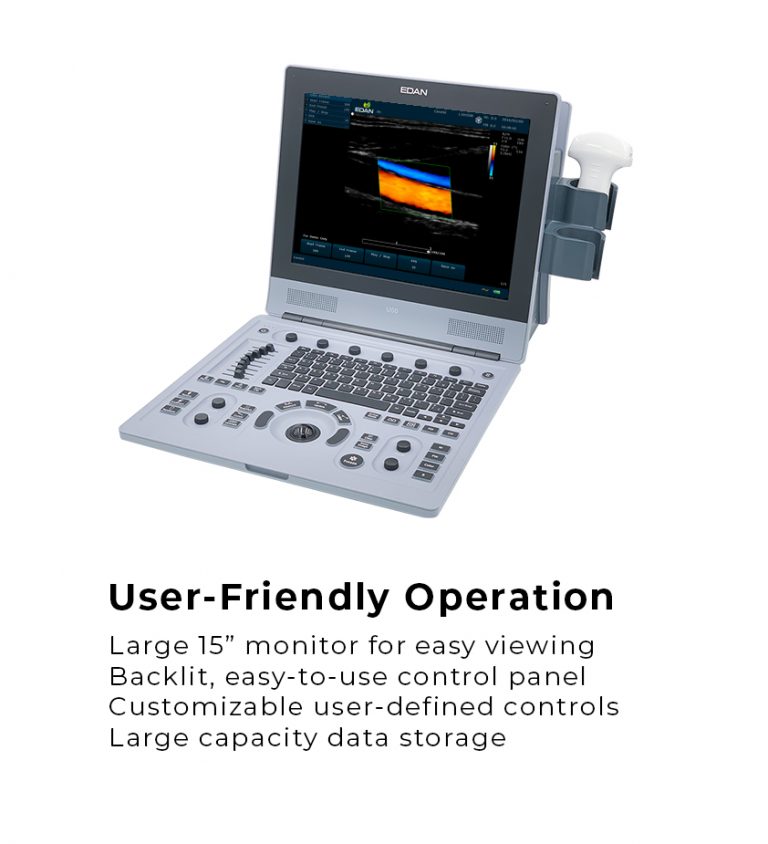 EdanUSA U60 Ultrasound Machine - EdanUSA