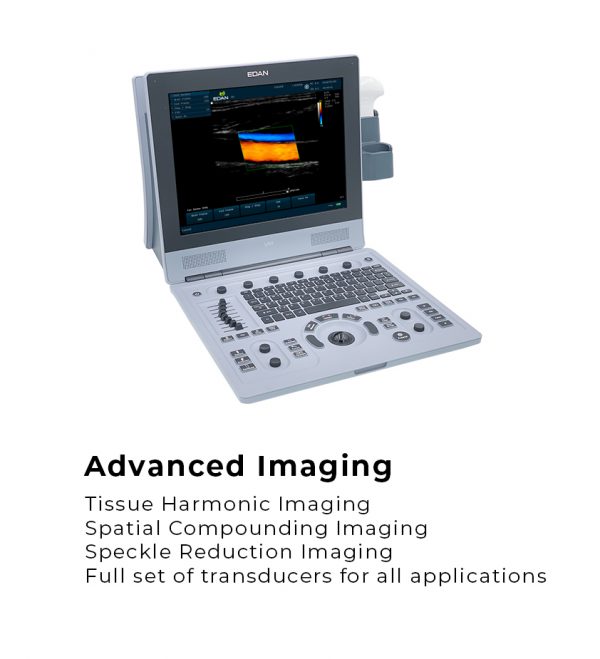 EdanUSA U60 Ultrasound Machine - EdanUSA